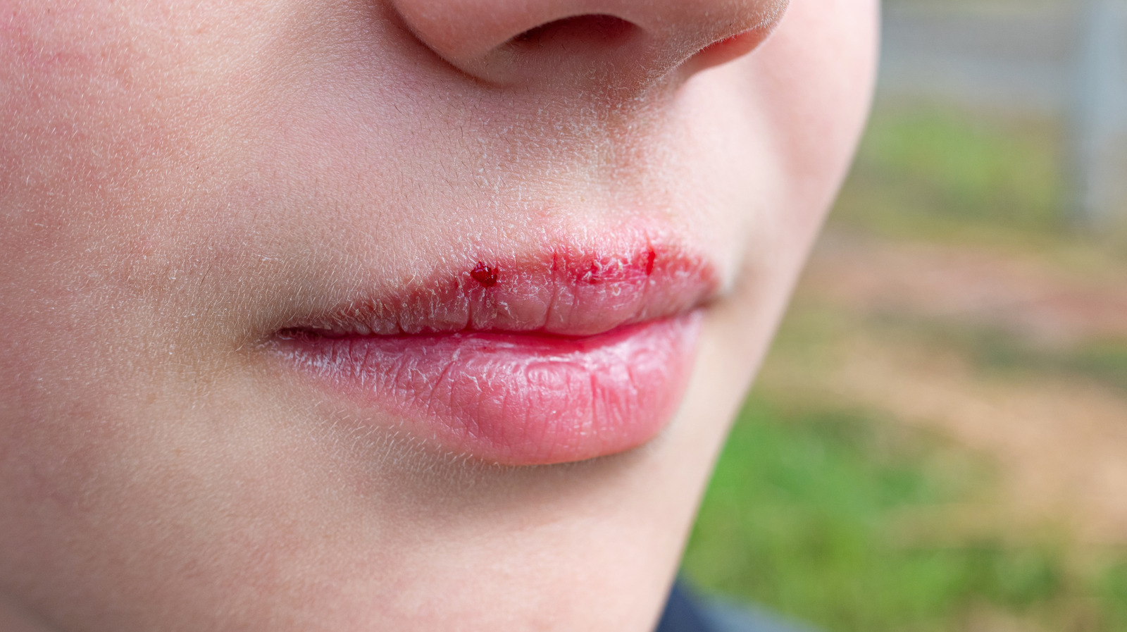 Cómo tratar los incómodos labios quemados por el sol | Estarguapas